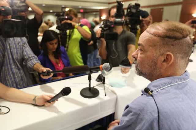US doctors perform skull-scalp transplant in major breakthrough | World ...