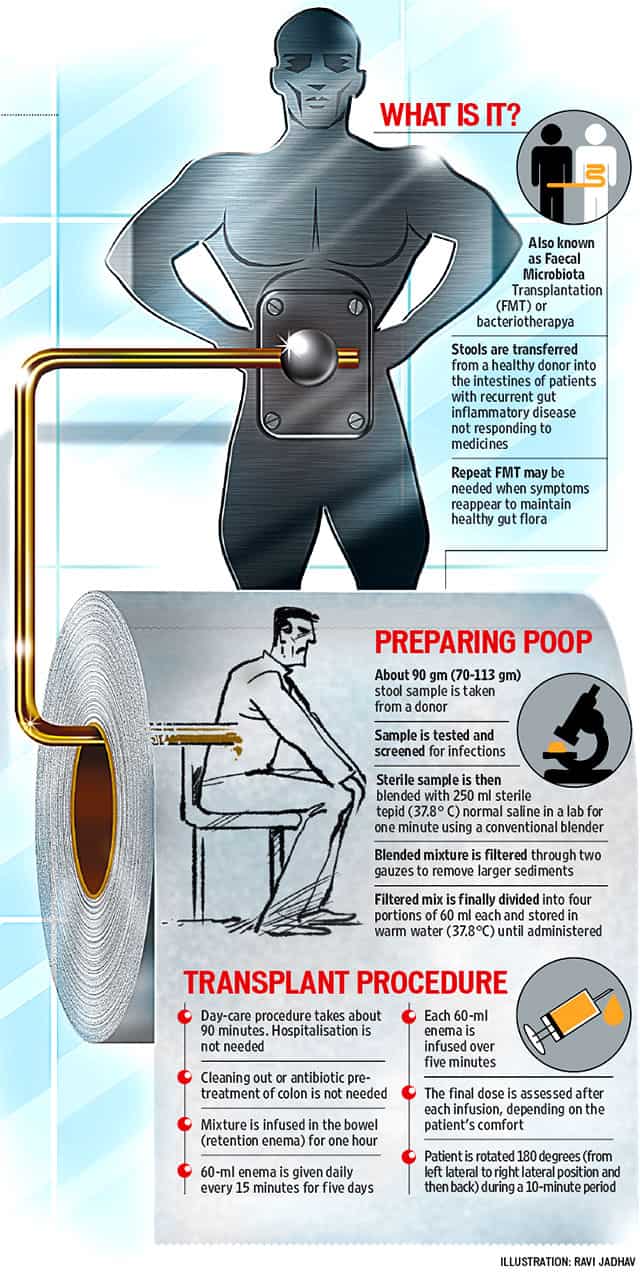 That gut feeling: Poop transplant to the rescue | Health - Hindustan Times