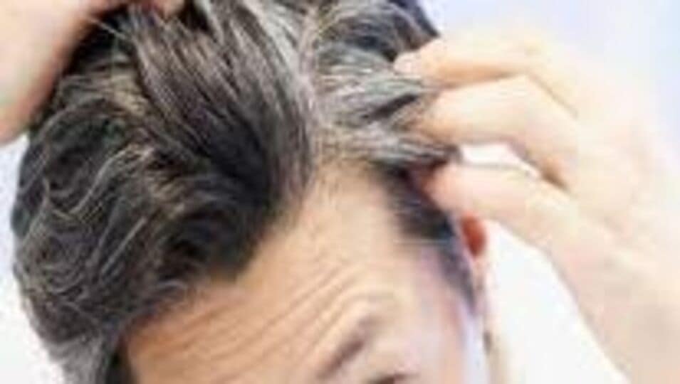 तारुण्यातच पांढऱ्या केसांनी त्रस्त आहात?, मग या घरगुती टिप्स वापराच...