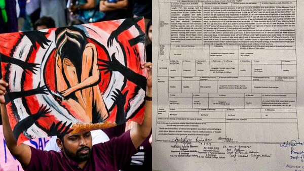 RG Kar Postmortem Report Expert Analysis: একজনই দোষী? এমনই কি বলা হয়েছে আরজি কর কাণ্ডের ...