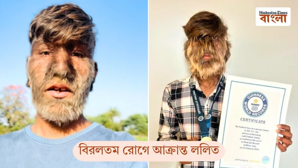 Viral News: ‘সহপাঠীরা ভয় পেত’! বিরলতম রোগে ভুগেই বিশ্বরেকর্ড গড়লেন আত্মবিশ্বাসী ললিত, টুকিটাকি ...