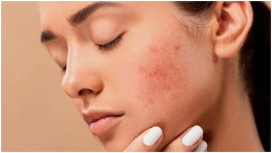 Rice water can work magically on your face and hair, here's how ...