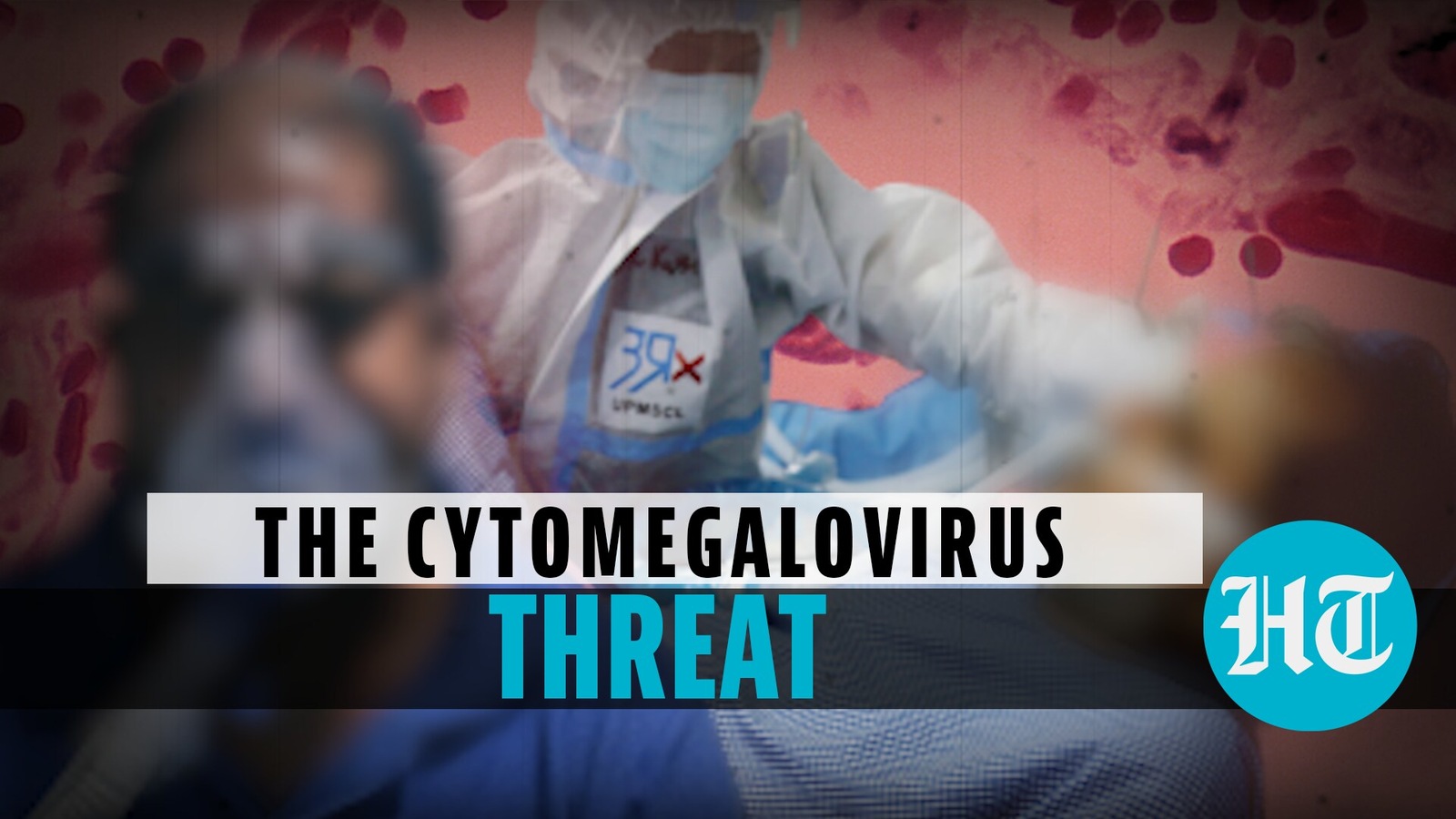 New post-Covid complications: Rectal bleeding in Delhi patients due to ...