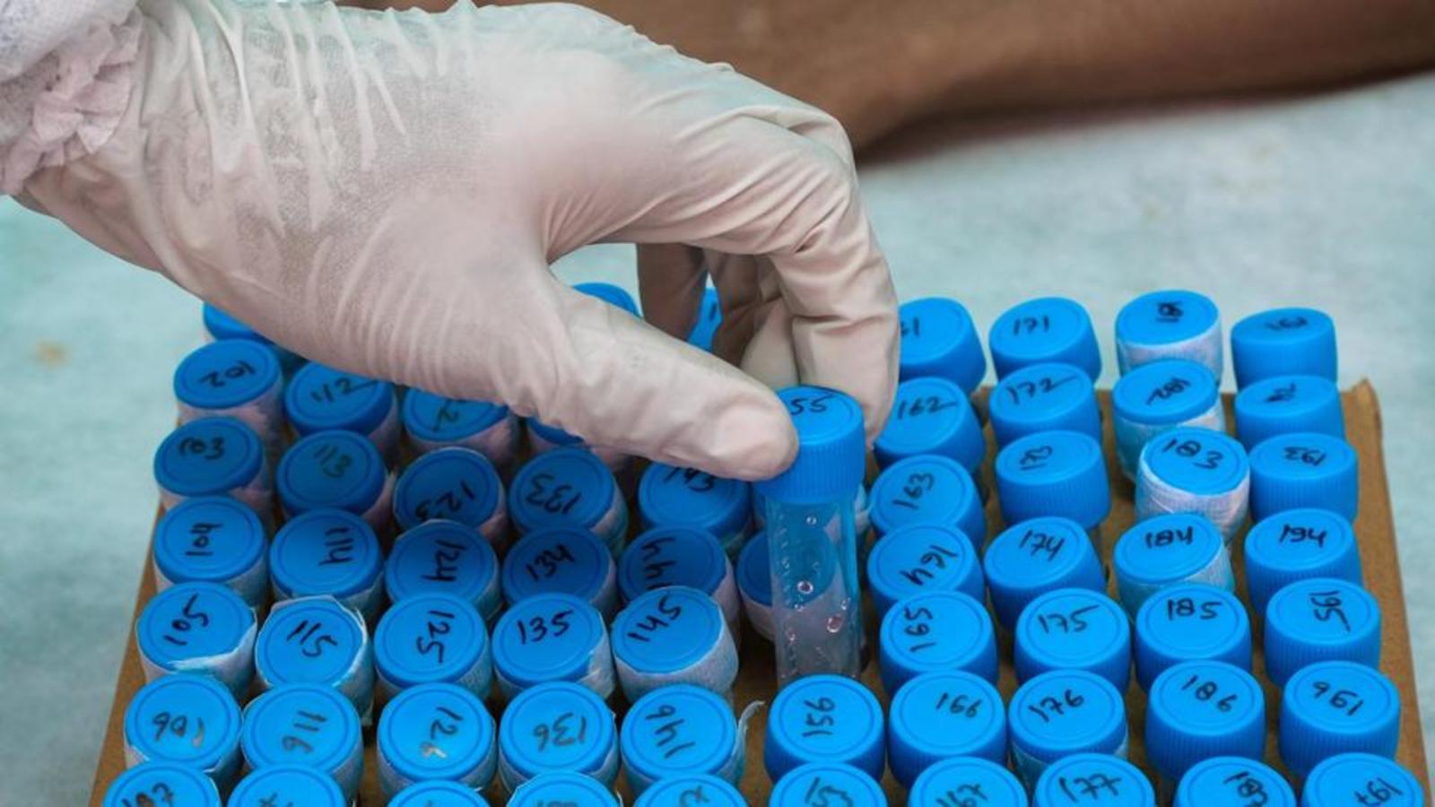 SGPGI nurse, kin test positive; samples sent for genome sequencing ...