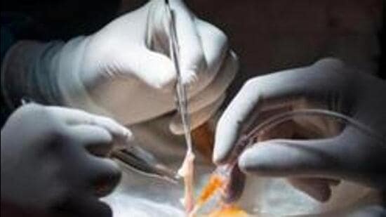 Kidney racket: State govt forms inquiry panel to investigate regional ...