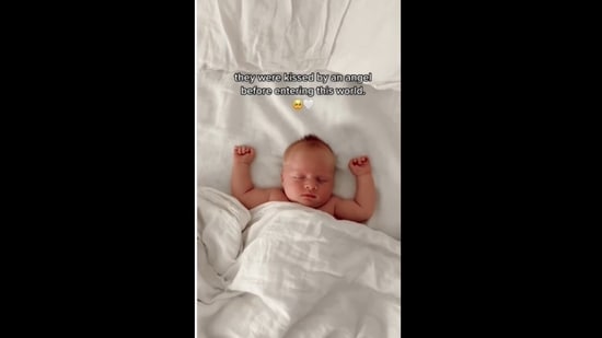 Baby born with a stork bite a few weeks after grandmother’s death ...