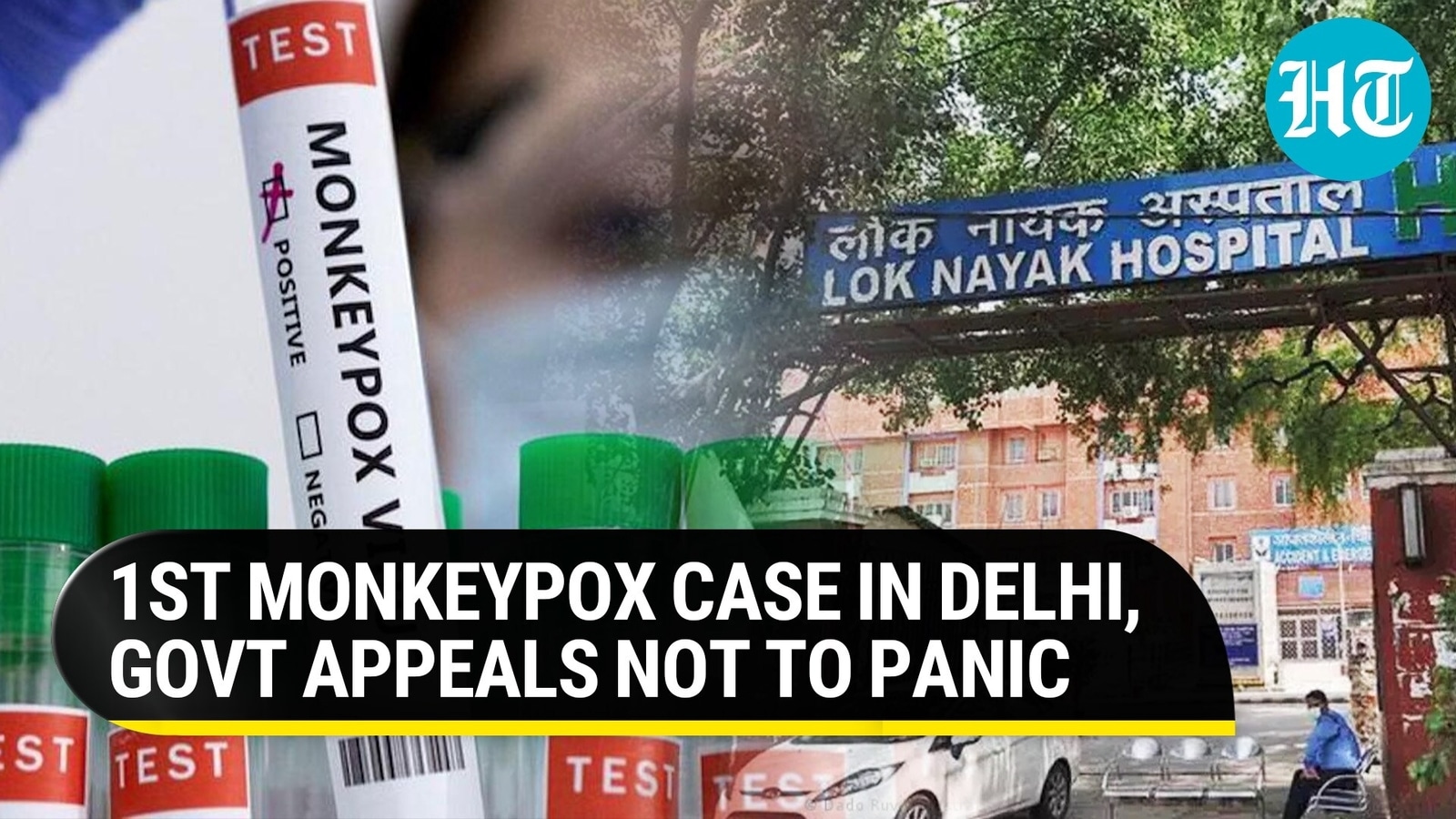 Delhi reports 1st case of monkeypox after WHO declared global health ...