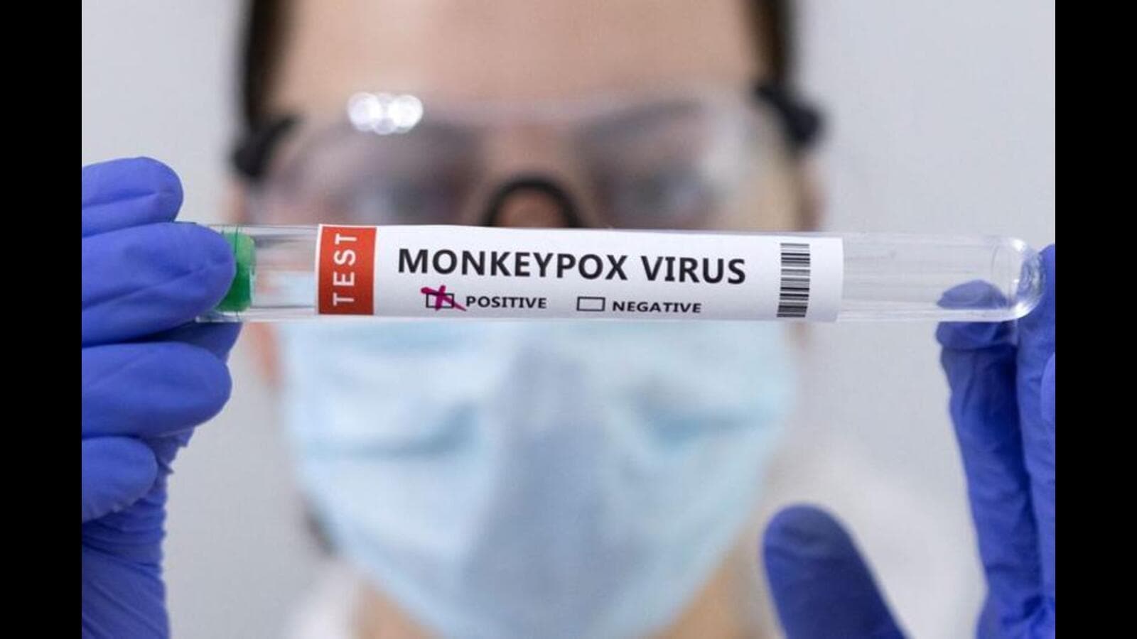 Patna woman’s samples taken for monkey pox test - Hindustan Times
