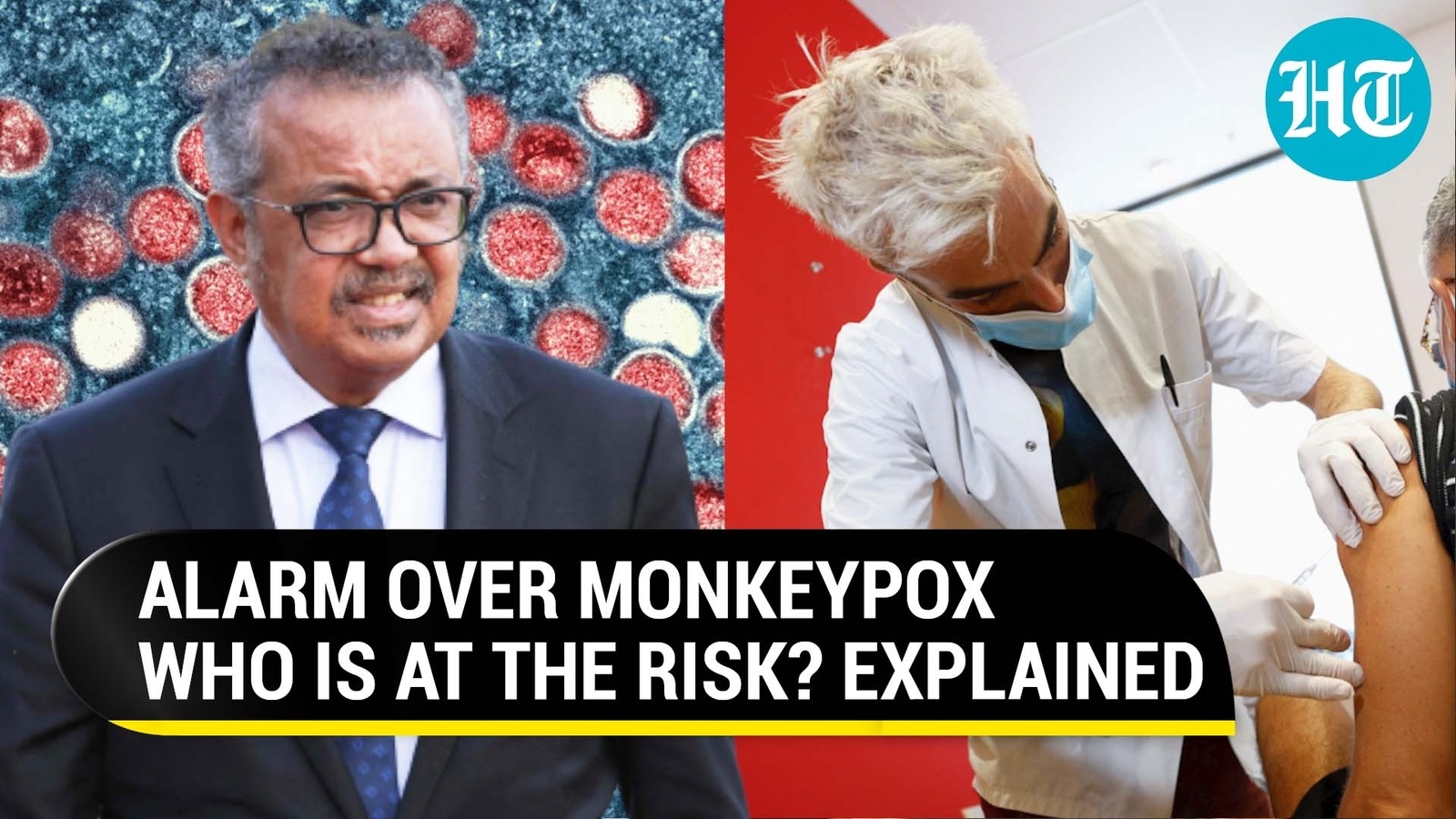 Monkeypox a sexually transmitted disease? Know how it spreads and how ...