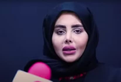 Iran's 'Zombie Angelina Jolie' shows real face; says viral look was a ...