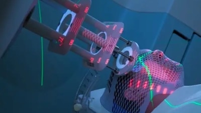 Role of radiotherapy intent in cancer care: Oncologist explains | Health