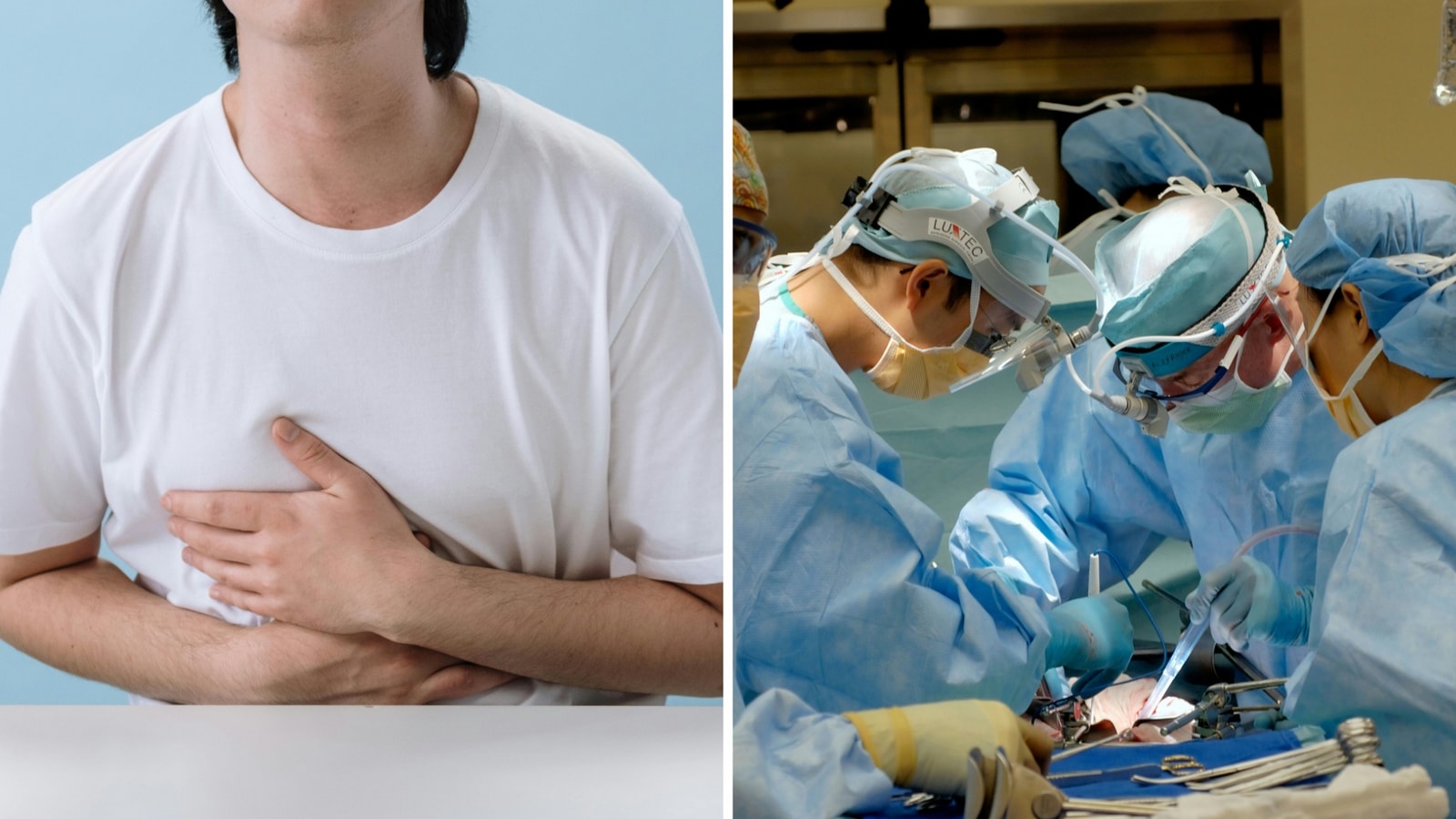 Doctors find uterus, ovary inside dad-of-two who went for a hernia operation in UP | Trending