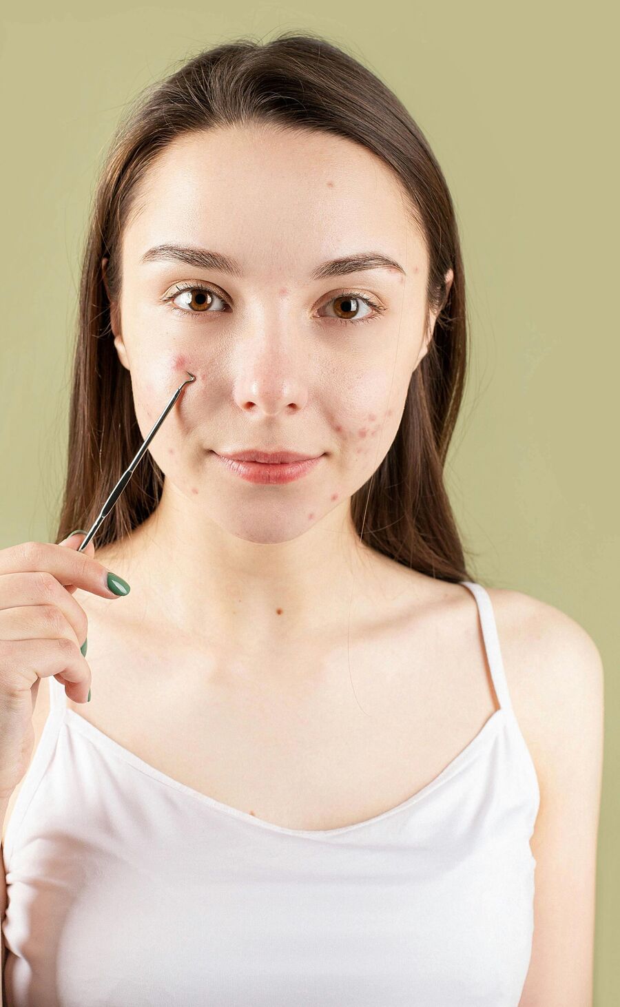 पावसाळ्यात पिंपल्सपासून सुटका मिळवण्यासाठी टिप्स