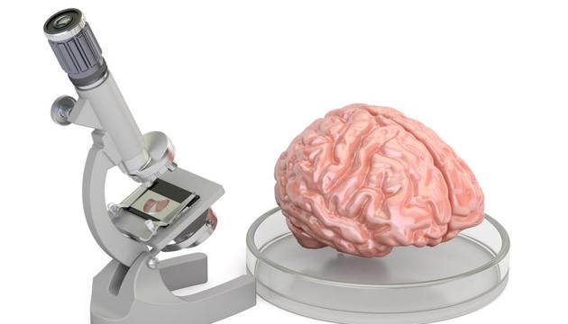 3D ‘mini-brains’ help understand rare developmental disorders | Health ...