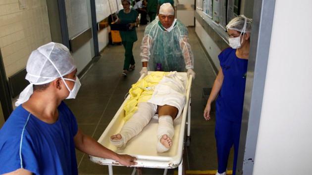 Photos: Brazilian doctors use Tilapia fish skin to treat burn victims ...