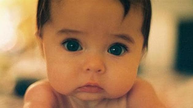 Here’s how to protect your baby’s soft skin from the winter cold | Health