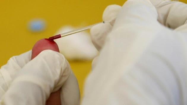 Soon, a bedside blood test could help detect brain injury, ensure ...