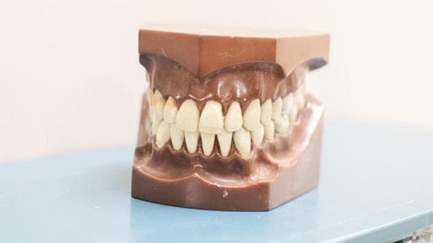 Say what? Construction workers find hundreds of teeth inside a wall in ...