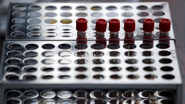 Mercedes-Benz research wing to provide 25,000 PCR testing kits to ...