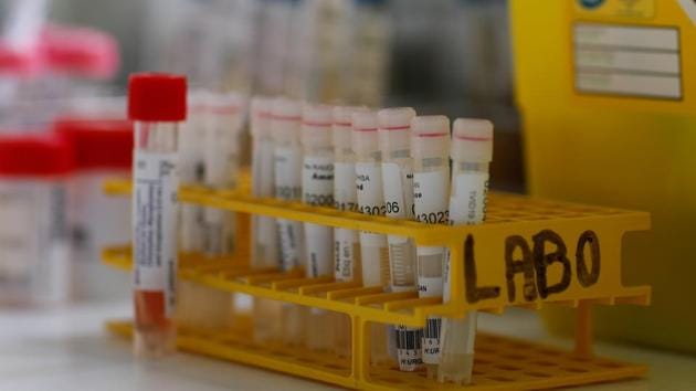 India sets up first mobile Covid-testing lab| India News