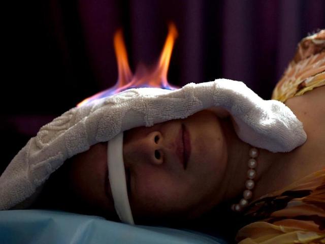 Burn, patient, burn: China's unusual medical therapy | World News
