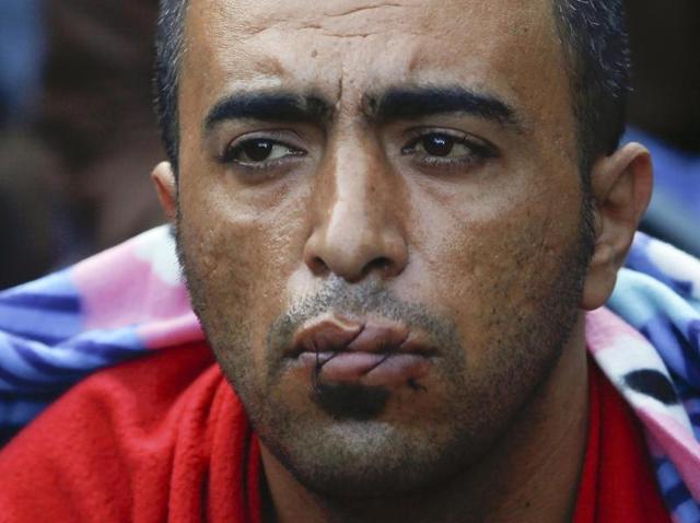 Migrants stranded at Greek-Macedonia border protest by sewing lips ...