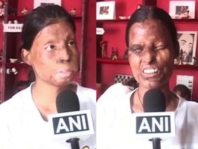 Café run by acid attack victims planned in Ghaziabad | Hindustan Times