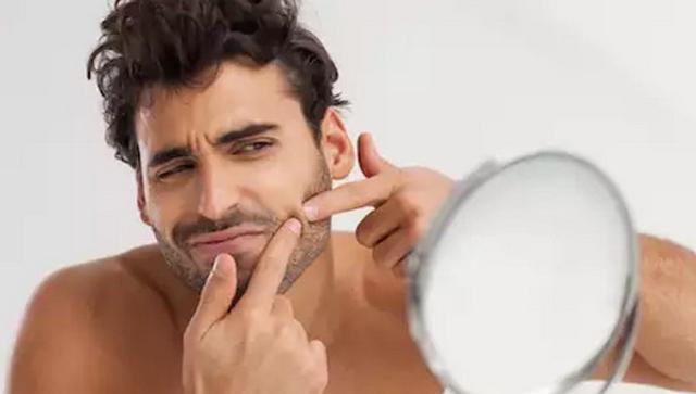 Men, this one’s for you: 4 simple ways to win over pimples | Health