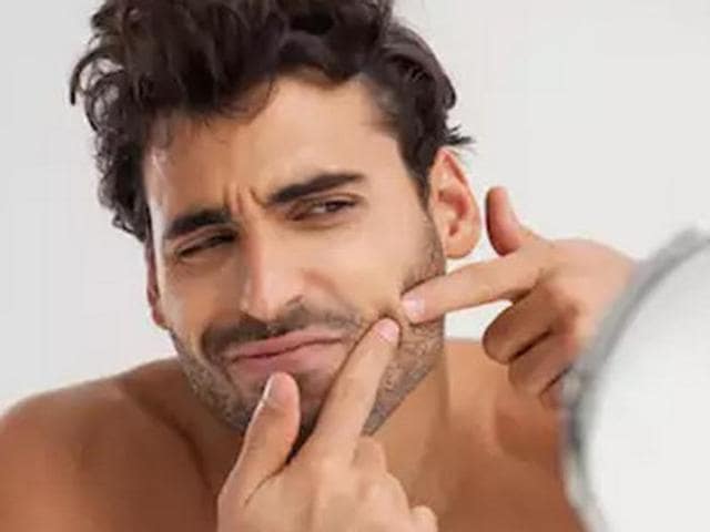 Men, this one’s for you: 4 simple ways to win over pimples | Health