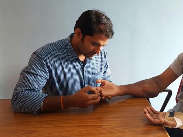 Handed back his life: India’s first forearm transplant surgery in Kochi ...