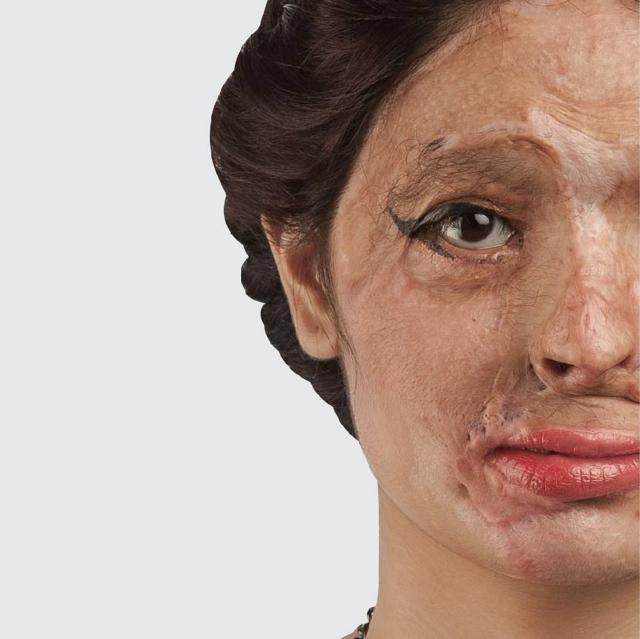 Reshma: Acid attack survivor who will model at New York Fashion Week ...