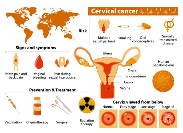 India, China have the largest number of breast and cervical cancer ...