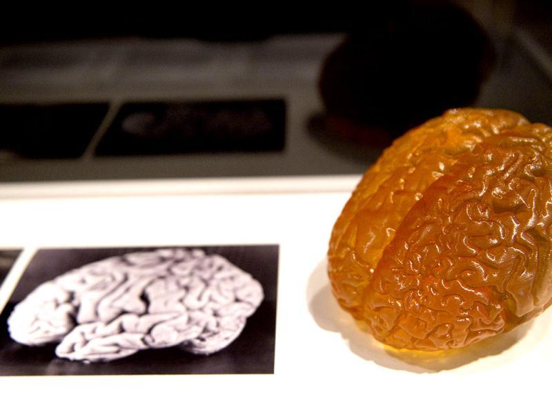 Scientists grow mini human brains in lab | World News