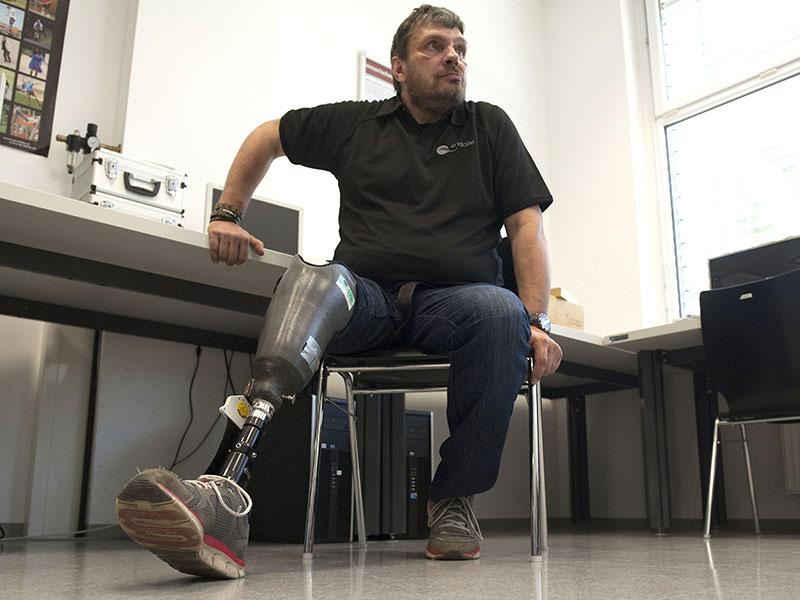 New hope for amputees: Here's world's first 'feeling' leg prosthesis ...