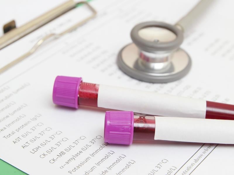A ‘sensitive’ blood test can now rule out heart attacks | Health ...