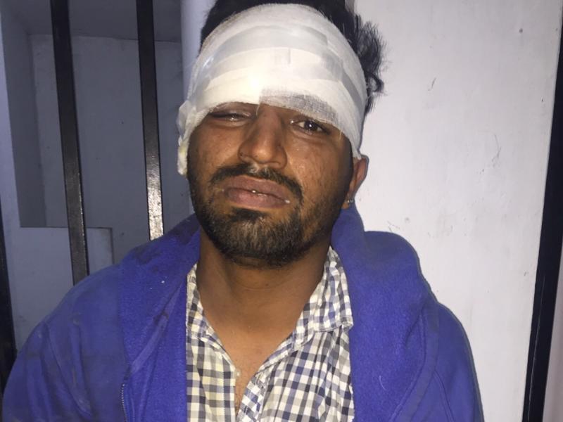 Chain snatcher ends life in police lock-up , judicial probe on ...