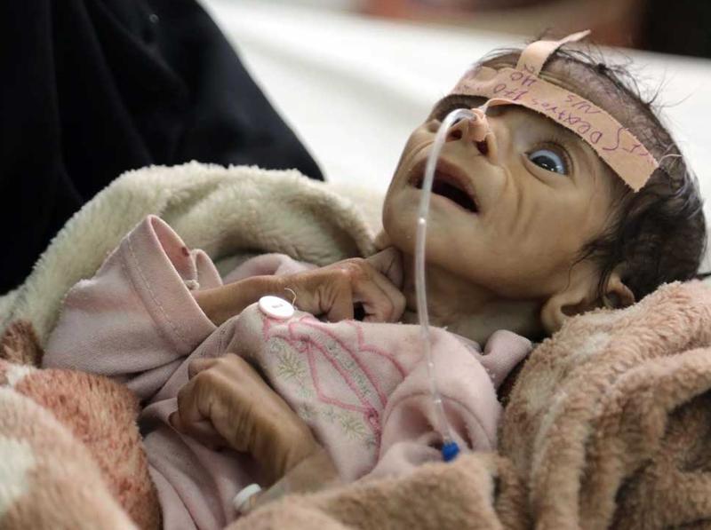 Watch | The heartbreaking story behind this starving baby’s image ...