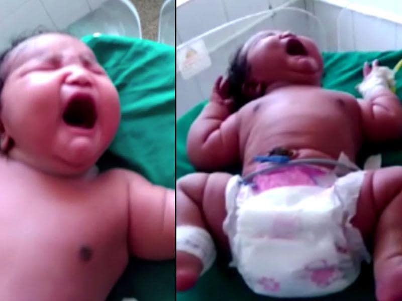 Watch | Meet the world’s heaviest newborn | Hindustan Times