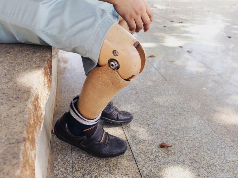 Delhi: Taekwondo champion loses both his legs to bullet injuries ...