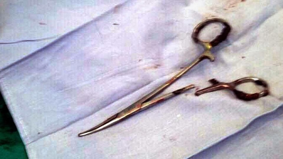 Scissors left inside man’s stomach during surgery, pulled out after 18 ...