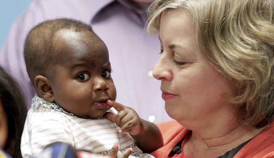 Baby born with extra legs thriving after surgery | World News