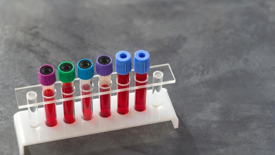 Get tested in time: A simple blood test can predict skin cancer’s ...