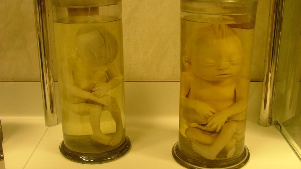 Babies’ bodies preserved in bottles found in abandoned house in Tokyo ...