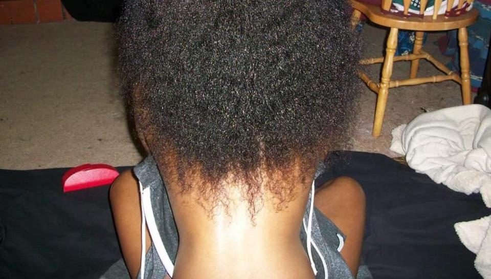 Neck or back? What do you see in this viral picture dividing the ...