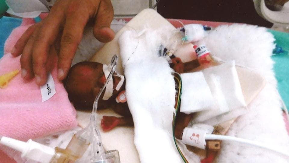 World’s lightest 258-gram baby boy ready to go home in Japan | World News