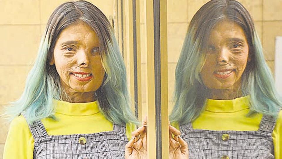 Looking beneath the scars: Burnt as a baby, this acid attack survivor ...