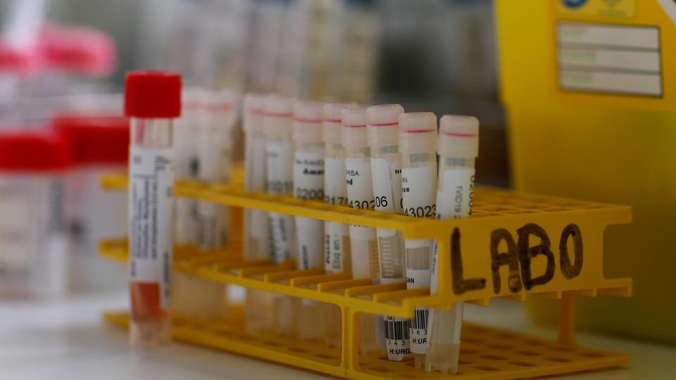 IIT Hyderabad researcher develops AI-powered low cost Covid-19 testing ...