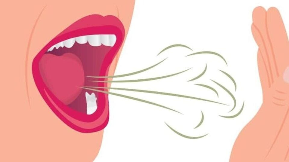 Bad Breath: வாய் துர்நாற்றத்தால் சிரமப்படுகிறீர்களா? இந்த எளிய முறையில் ...
