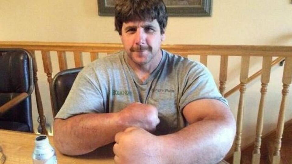 ఇతని చేతులేంటి.. ఇంత 'భారీగా' ఉన్నాయి!-people are shocked at the size ...